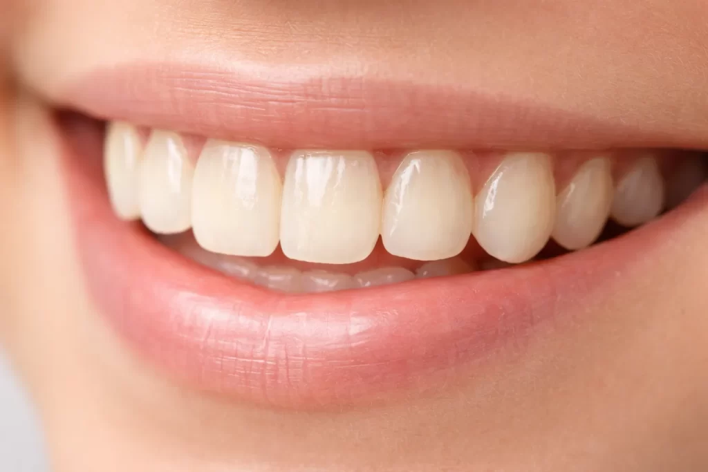 Signs of Enamel Erosion and How to Recognise Them Early
